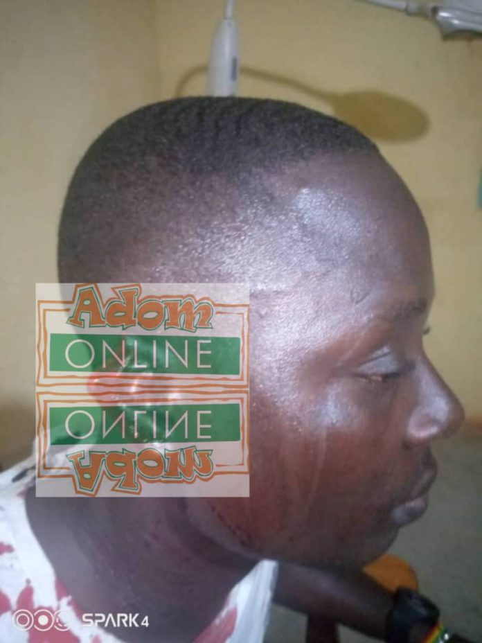 Police officer chews off bar operator's ear over 'alcohol' consumed ...