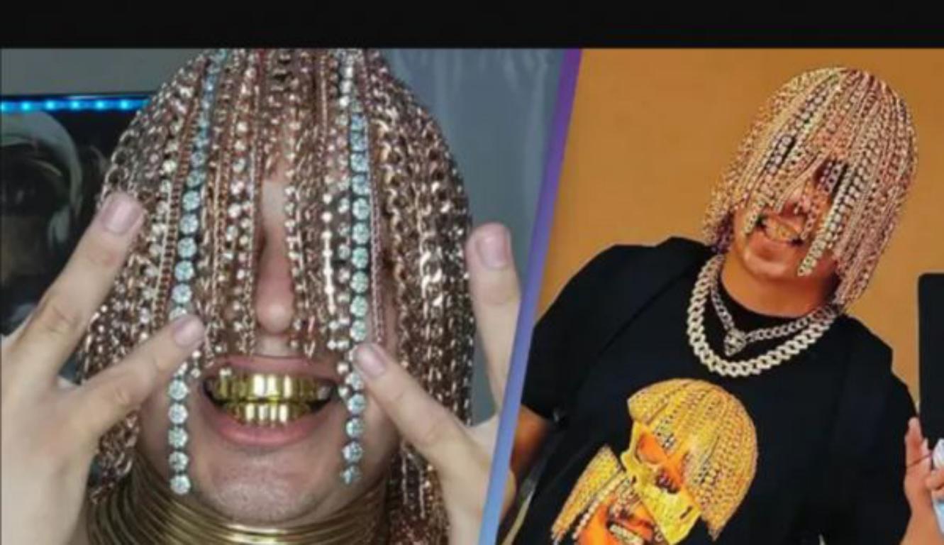 Rapper gets gold chains surgically implanted into his head [Video ...