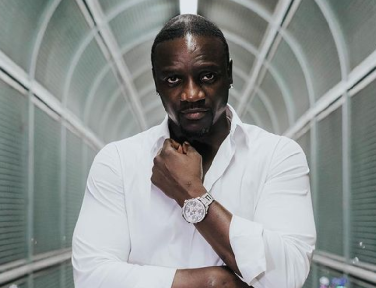 Akon reveals he got a hair transplant worth $7,500 - Adomonline.com