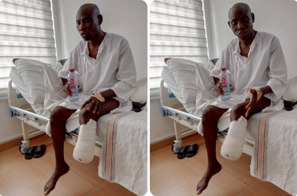 NPP has neglected me after my leg was amputated - Bahmed - Adomonline.com