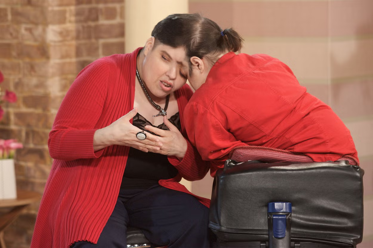 World's oldest conjoined twins die at 62 - Adomonline.com