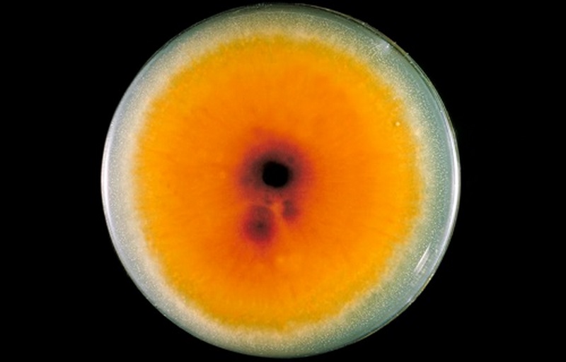 New sexually transmitted infection 'Trichophyton mentagrophytes type ...