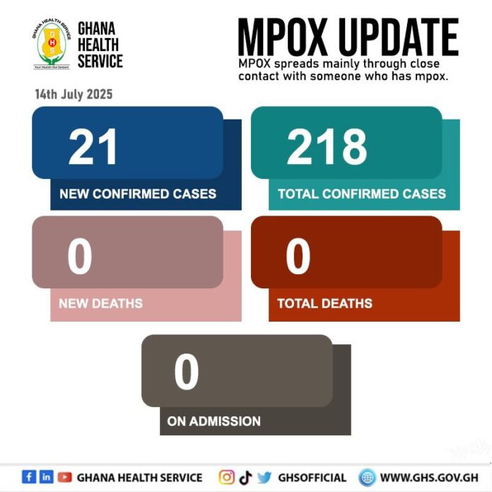 GHS confirms 21 new Mpox cases, total rises to 218